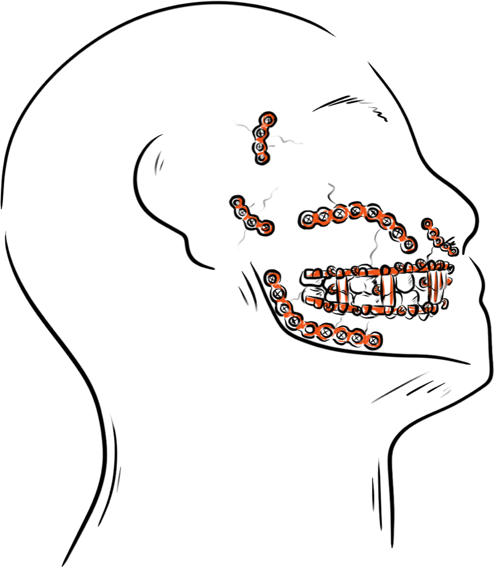 Oral Surgeon Long Island, NY | Gold Coast Oral & Maxillofacial Surgery ...